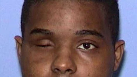 Murderer who ate his own eyeball is crazy, but that won’t stop his ...